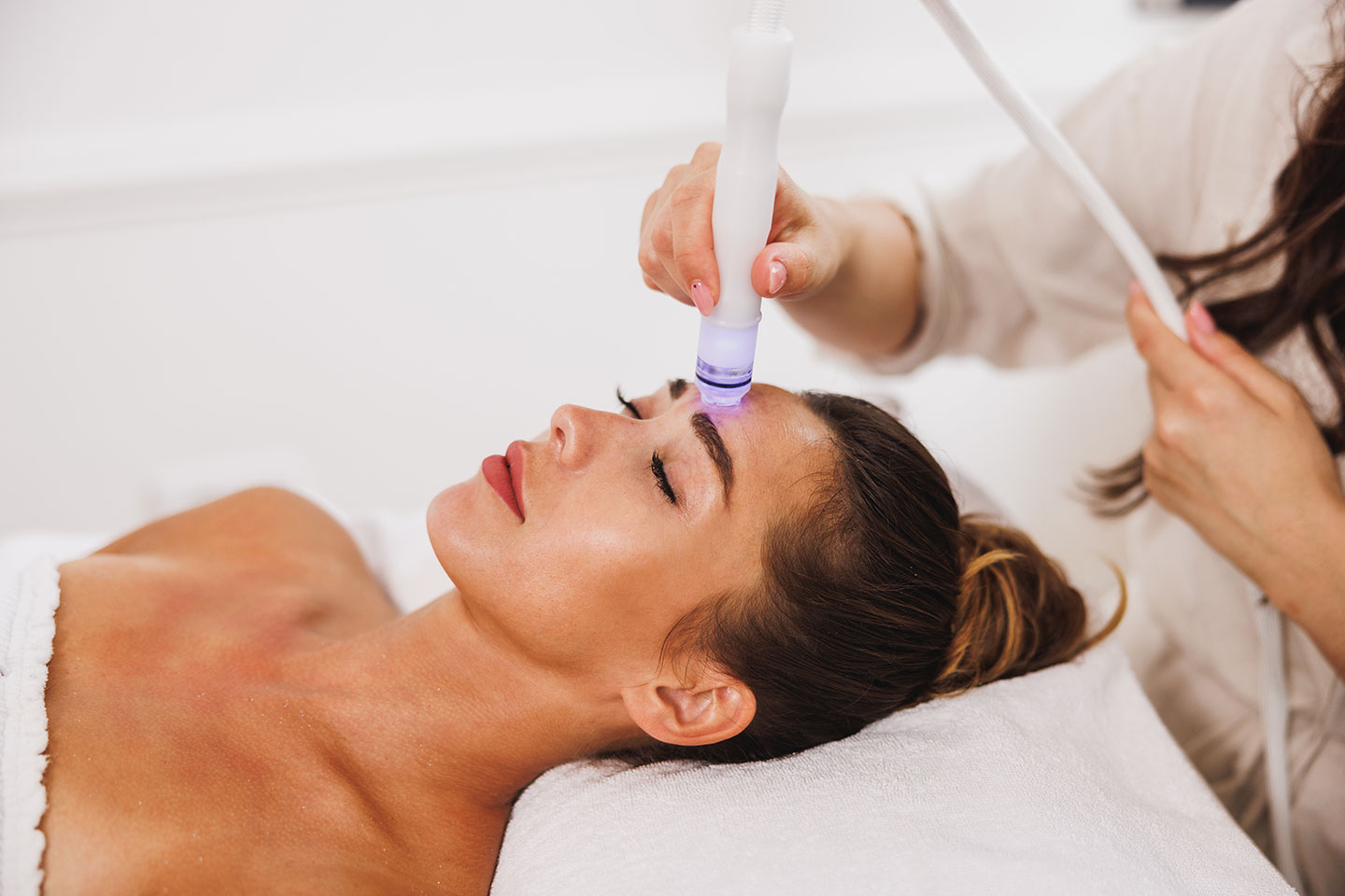 Plasma pen behandling hos Face Portal i Nya Gårda | Let’s deal